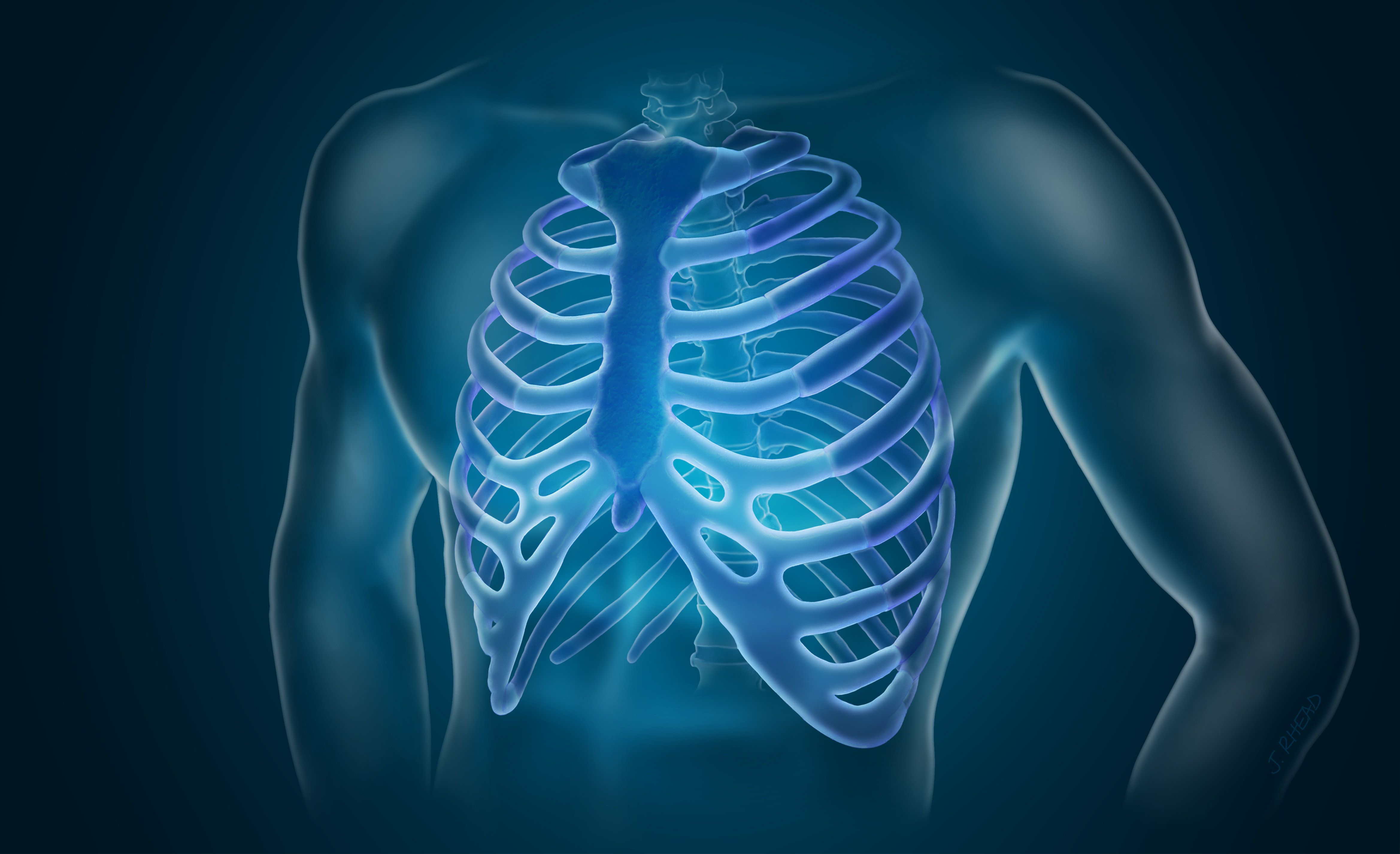 CWIS graphic-rev2 – Chest Wall Injury Society